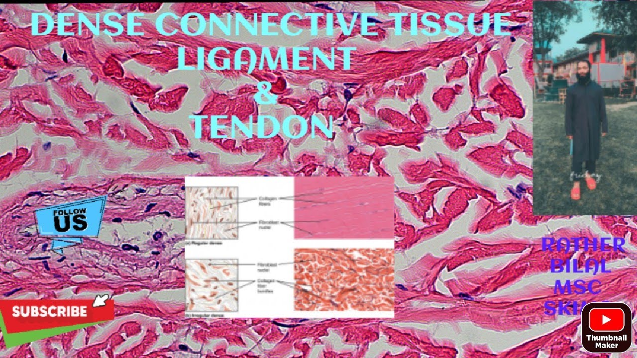 Dense Connective Tissue | Ligament & Tendon | #dense connective tissue ...