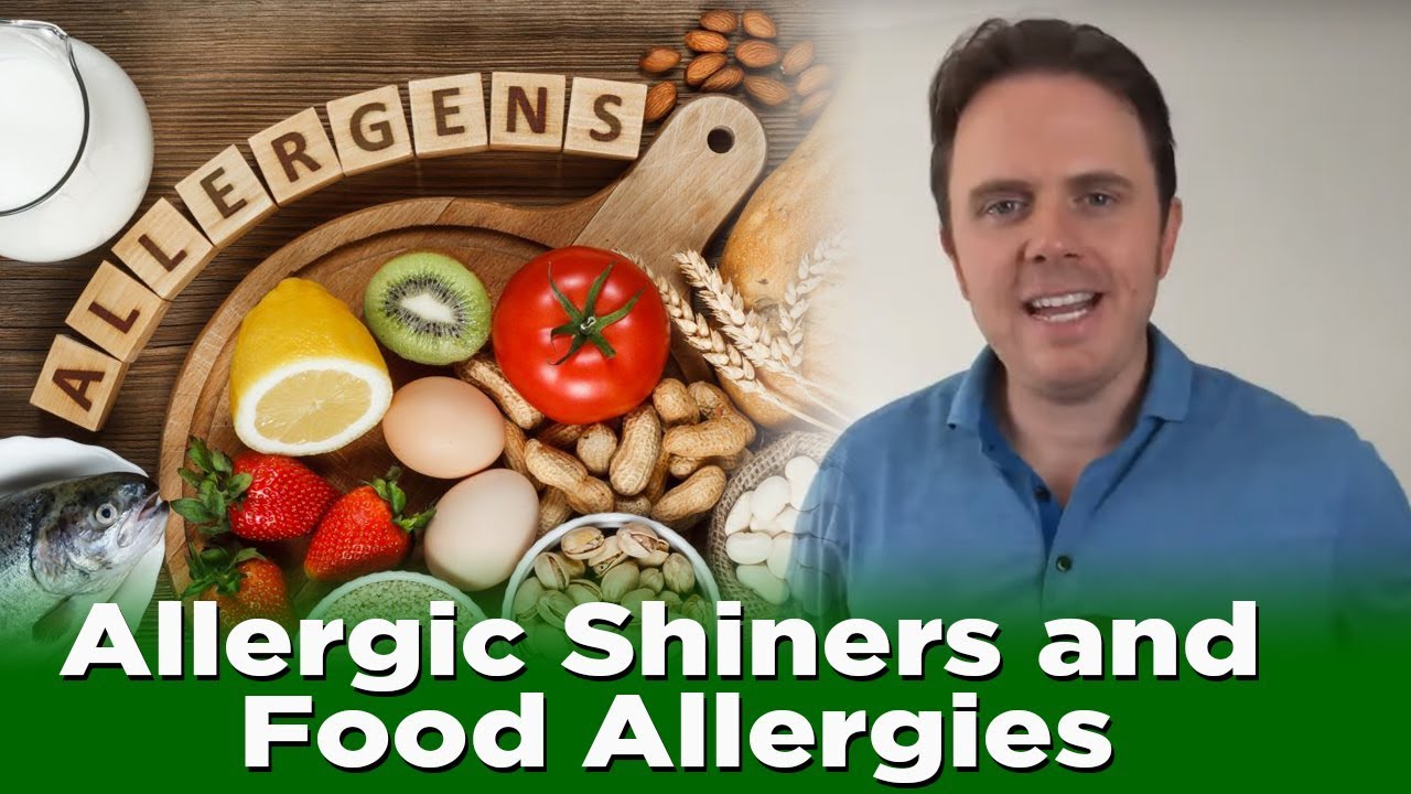 Allergic Shiners and Food Allergies | Dr. J Q & A - YouTube