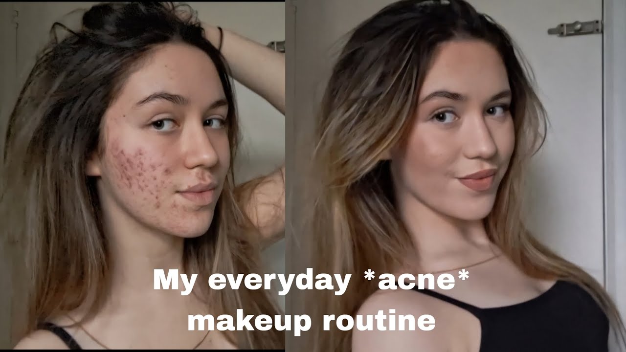My Everyday Makeup Routine (On Acne Skin) - YouTube