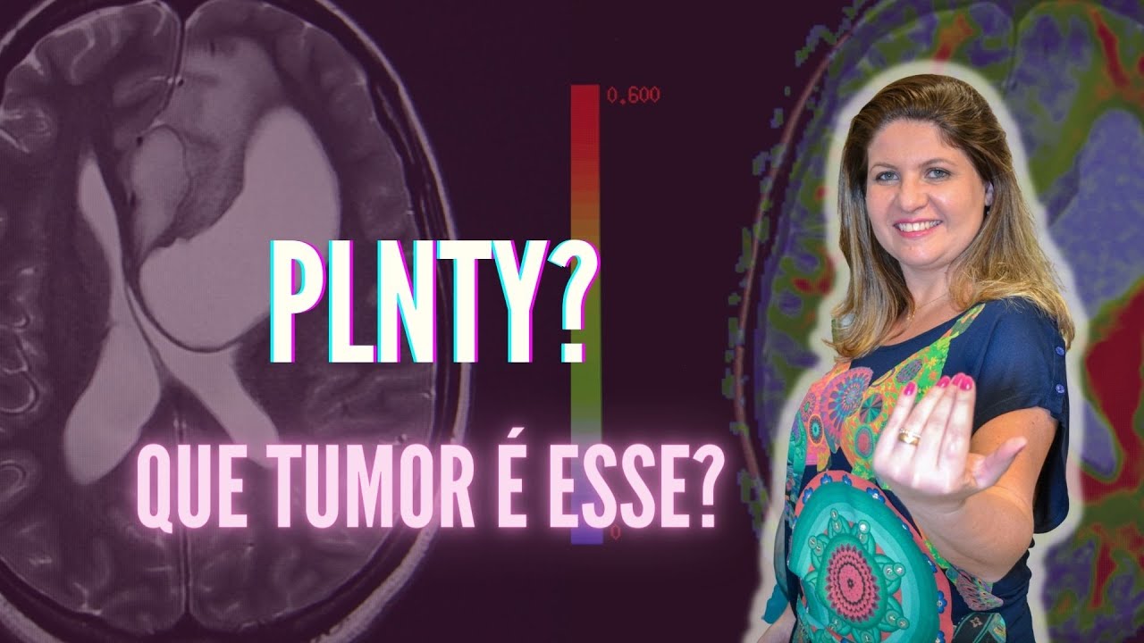 PLNTY: você sabe diagnosticar esse novo tipo de tumor? - YouTube