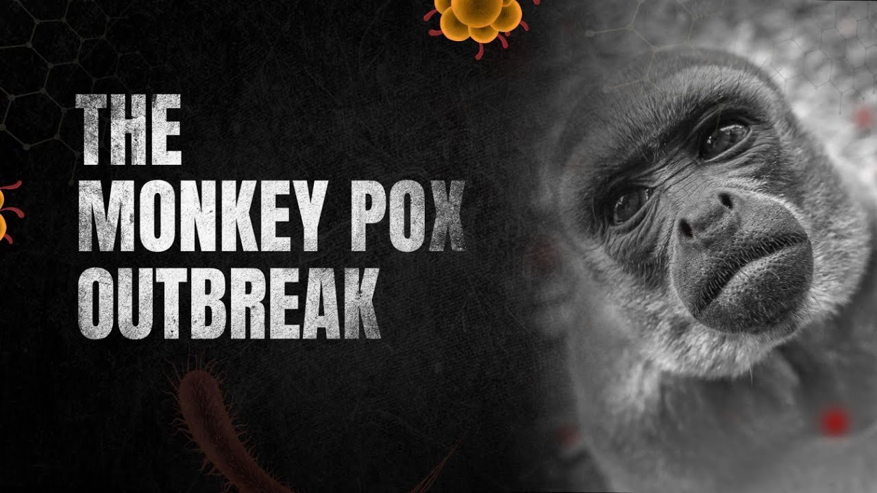 MonkeyPox - The next big Outbreak Under 6 Minutes - YouTube
