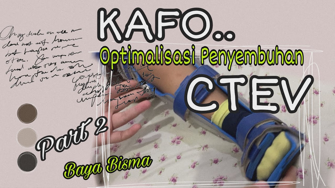 5 Hal Yang Perlu Diketahui Mengenai Sepatu CTEV : KAFO (Knee Ankle Foot ...