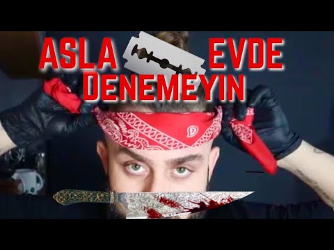 Ustura ile Balon Traş Etmek