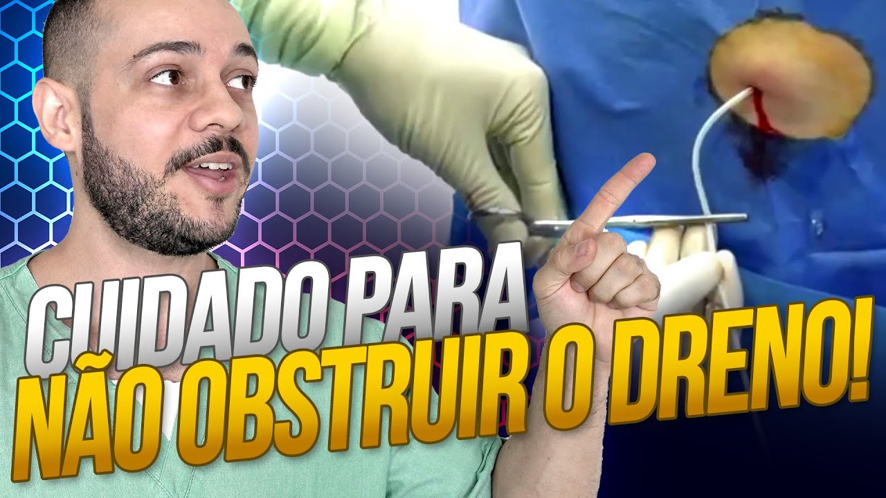 Toracocentese com ajuda da ultrassonografia - YouTube