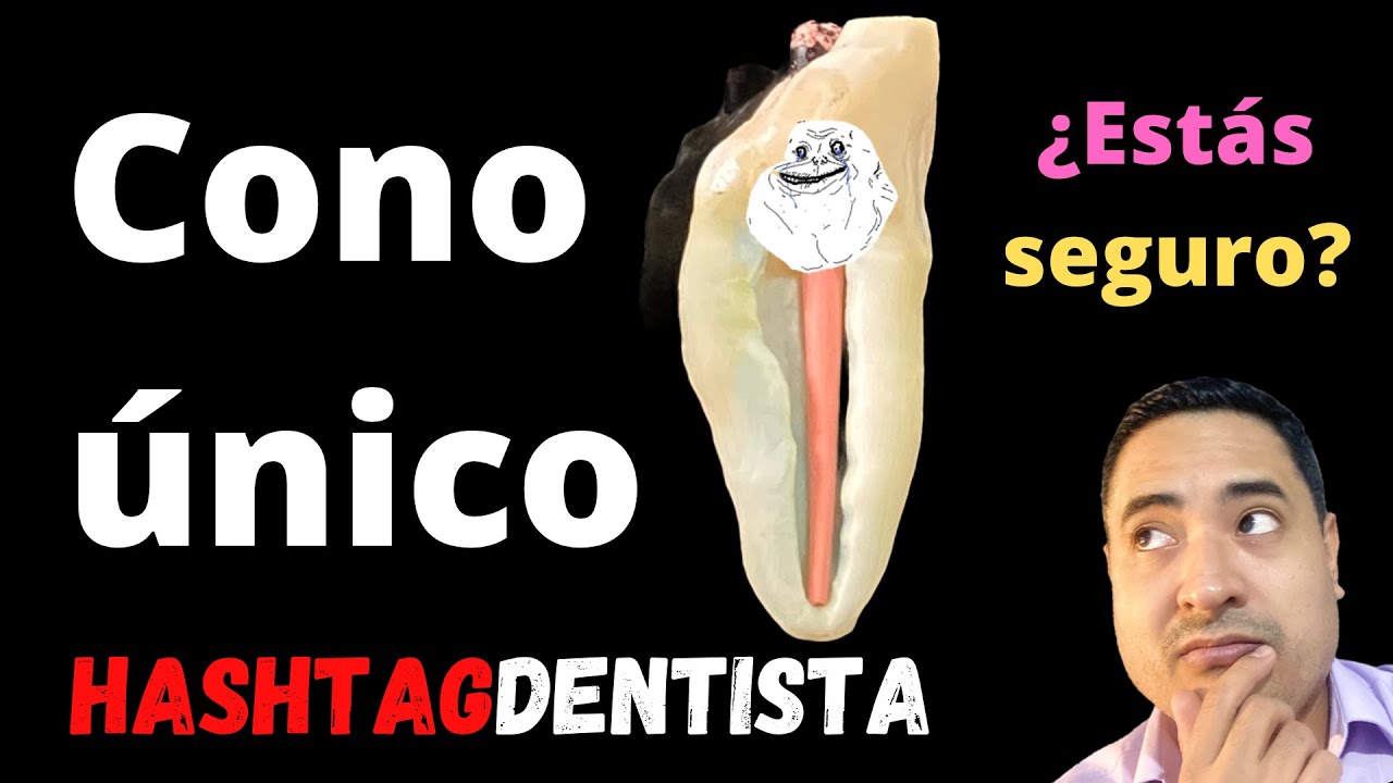 Técnica De Cono único Hay Cosas Que Debes Saber Antes Youtube