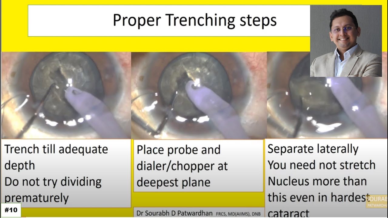 Chapter 3: Trenching technique final with audio - YouTube