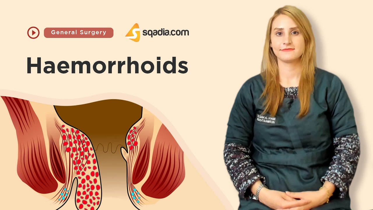 Haemorrhoids | Definition, Causes, Clinical Features | Haemorrhoidopexy ...