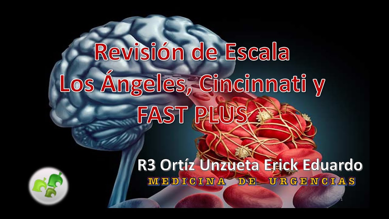 Revisión de las Escalas: Los Ángeles, Cincinnati y FAST Plus - YouTube