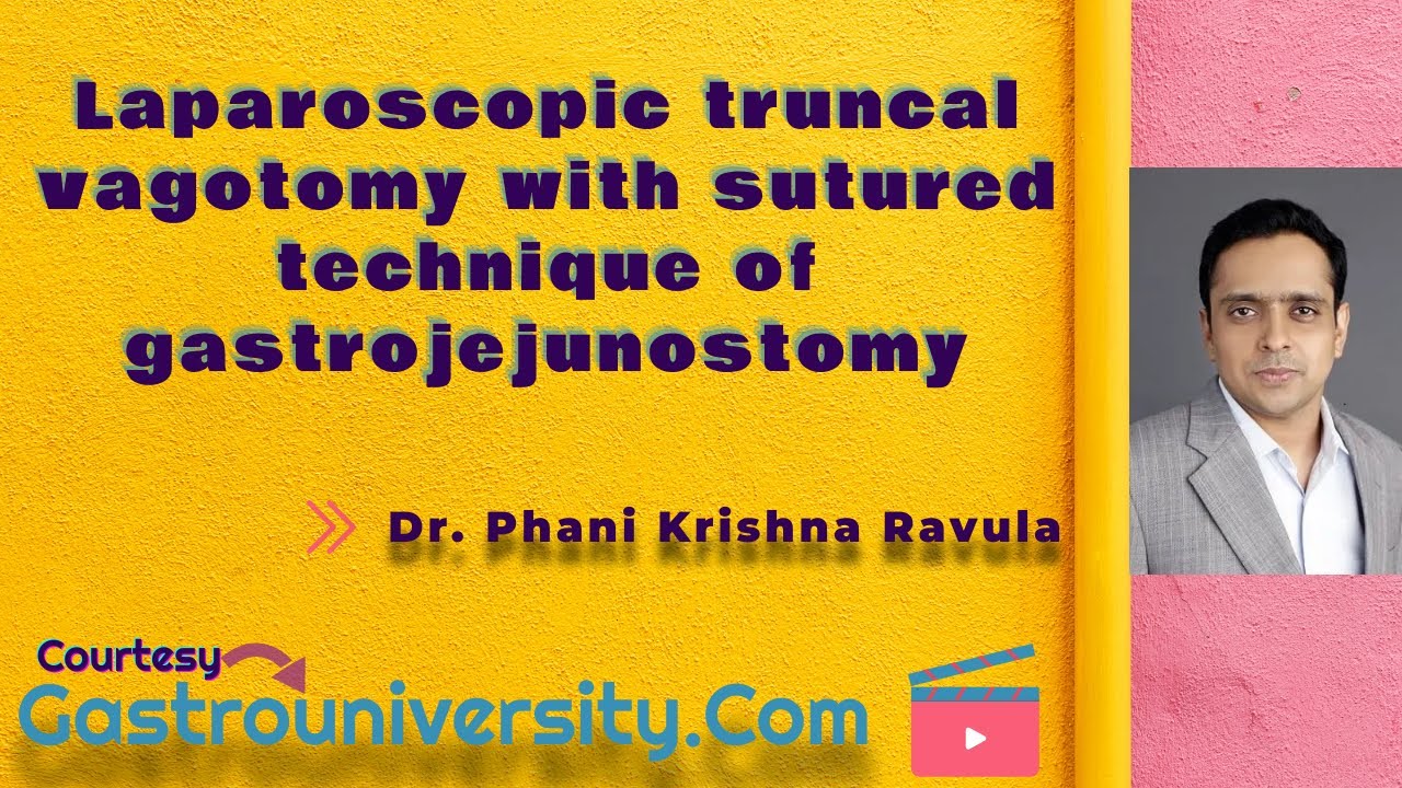 Stomach-Laparoscopic truncal vagotomy with sutured technique of ...