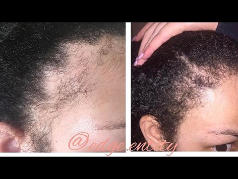 How to Grow Your Edges Back With Edge Entity - YouTube