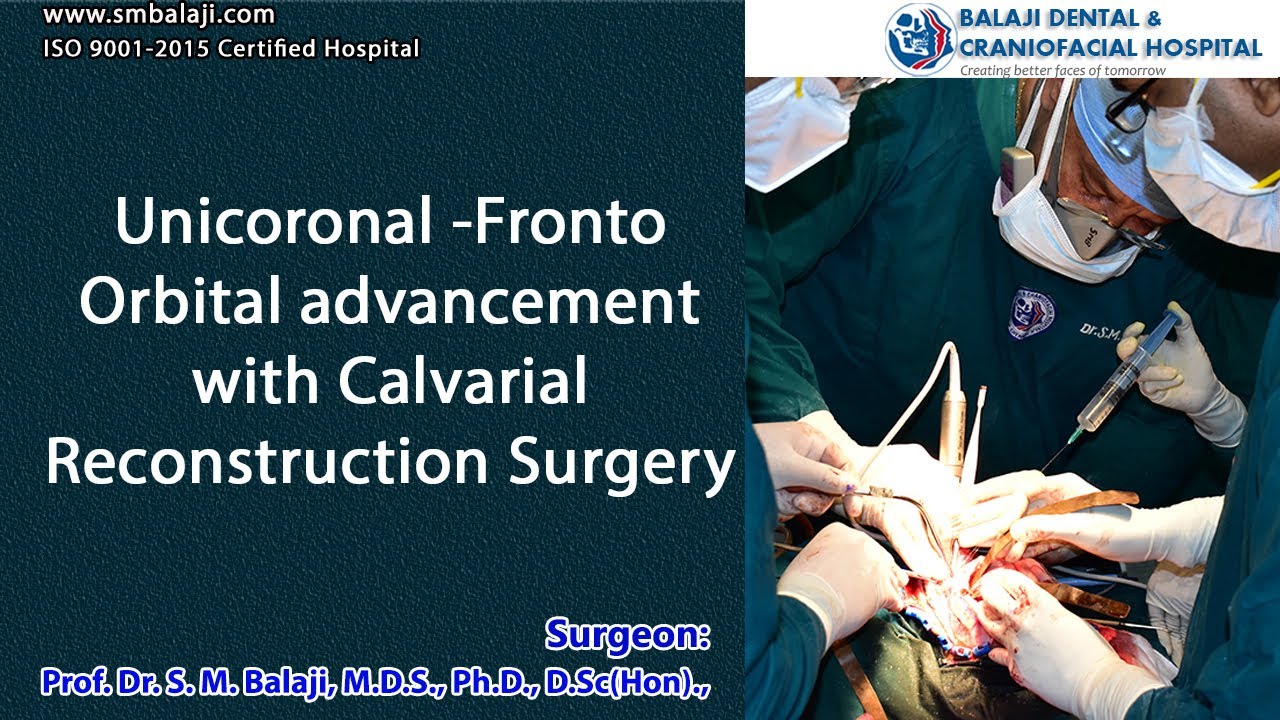 Unicoronal Fronto Orbital advancement with Calvarial Reconstruction ...