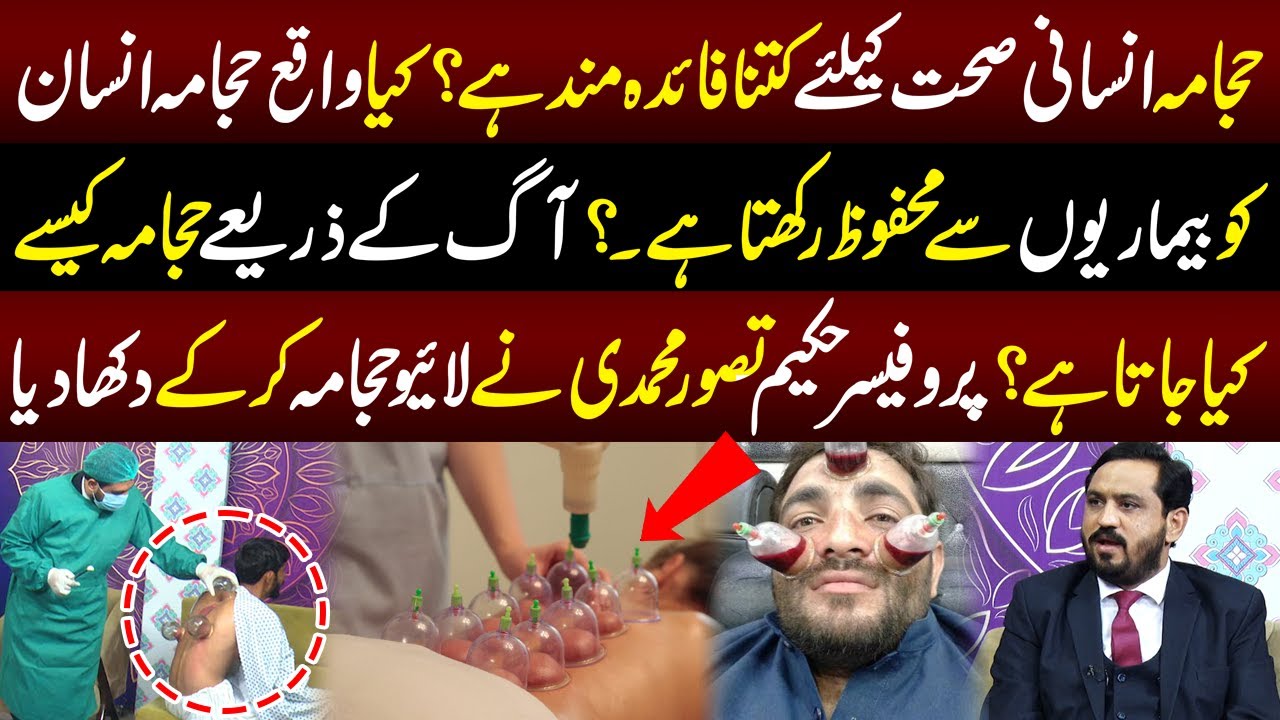 Aag Se Hajama Kaise Kiya Jata Hai ?? Hakeem Sahib Ne Live Hajama Kar ...