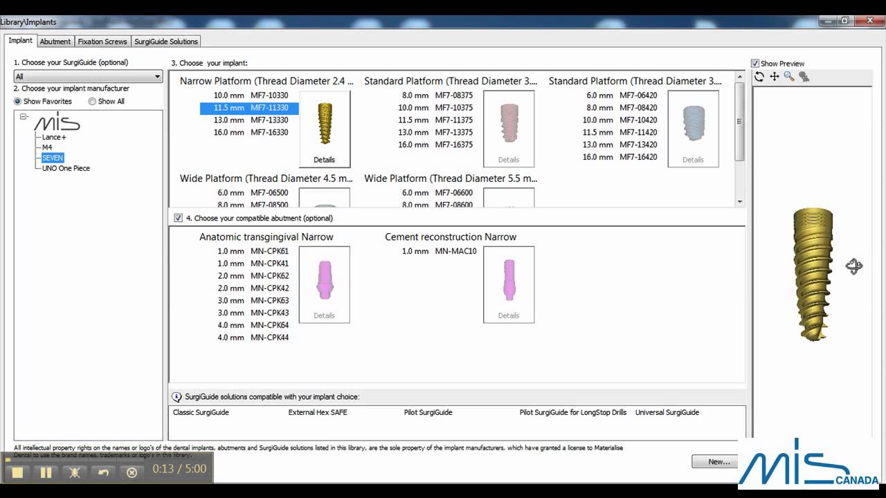 MIS Implant library within Simplant HD - YouTube