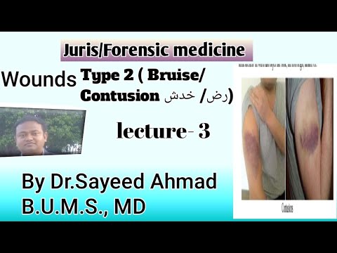 Juris/forensic medicine ||Wounds ||type ,BRUISE ||UNANI MEDICINE ...