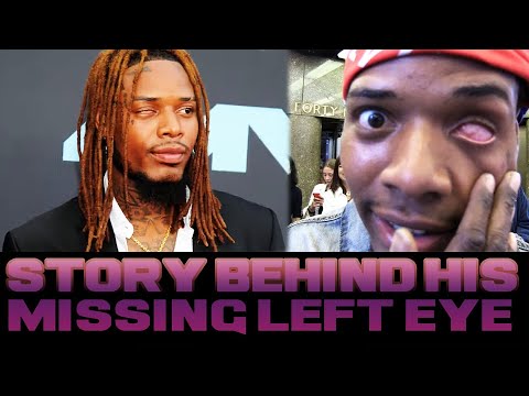 Fetty Wap Opens Up: The Story Behind His Missing Left Eye - YouTube
