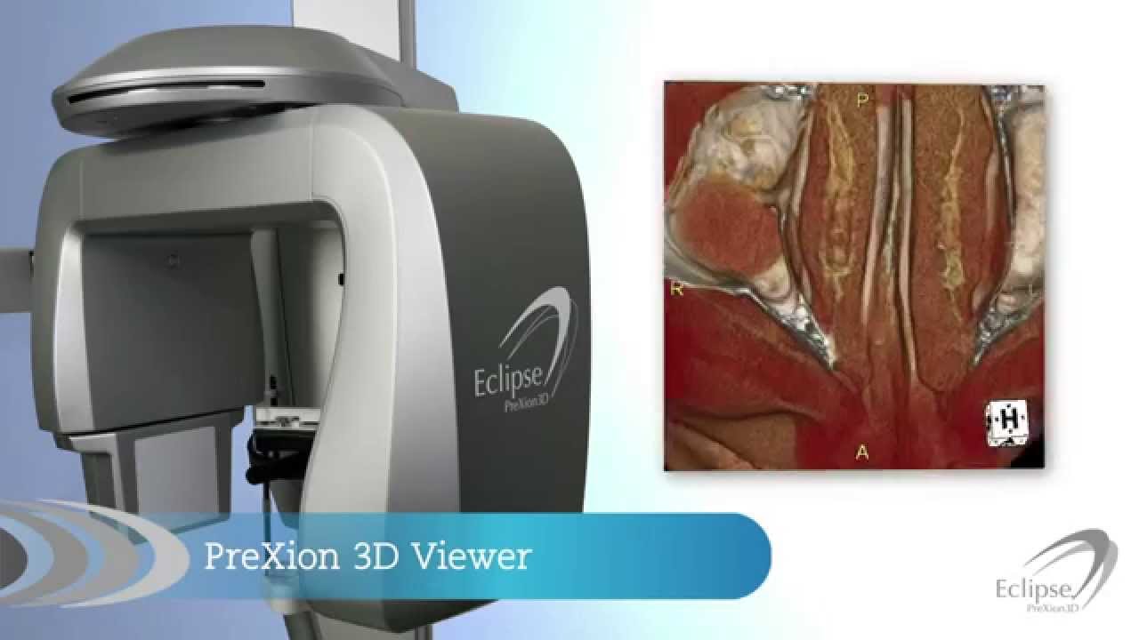 Prexion3D Viewer Software - YouTube