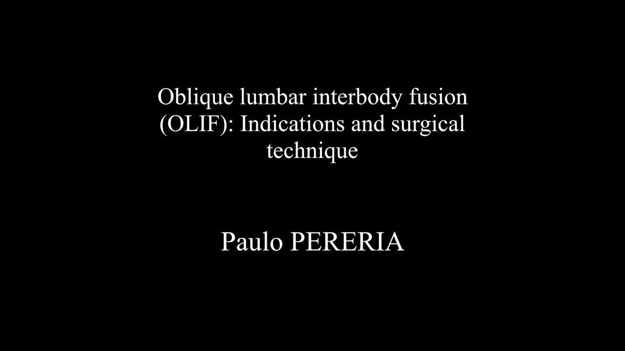 Oblique lumbar interbody fusion (OLIF): Indications and surgical ...