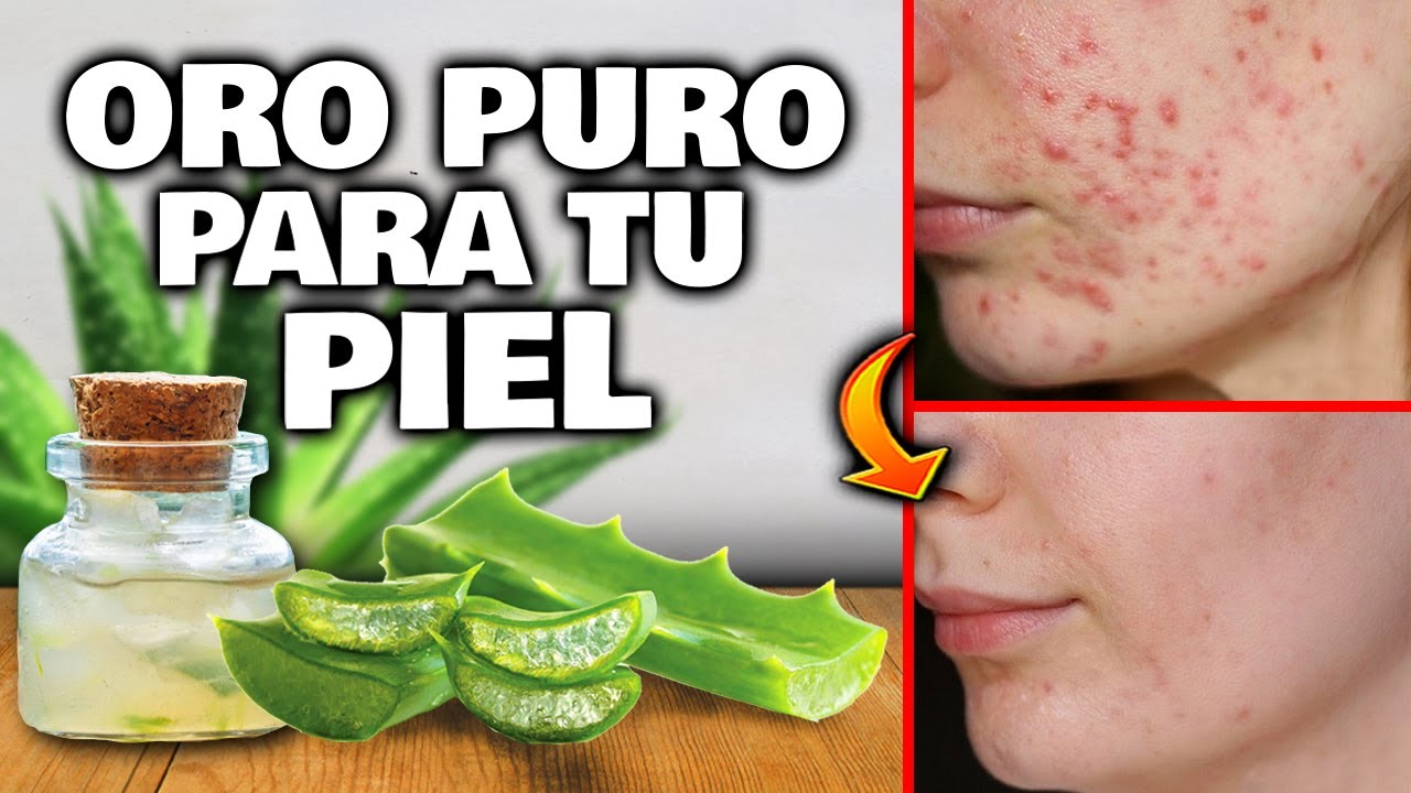 Aplica SÁBILA o ALOE VERA en tu cara A DIARIO y MIRA que OCURRE ...