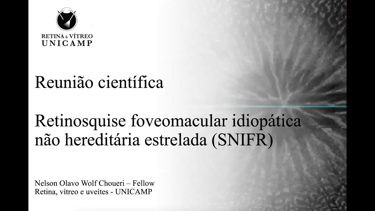 Retina e Vítreo (18/09/2025)- Retinosquise Foveomacular Não Hereditária ...