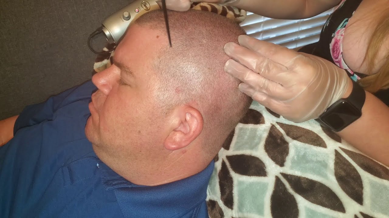 [ASMR] Head Scratching | Scalp Check | Head Massage | Relaxing 😴 - YouTube