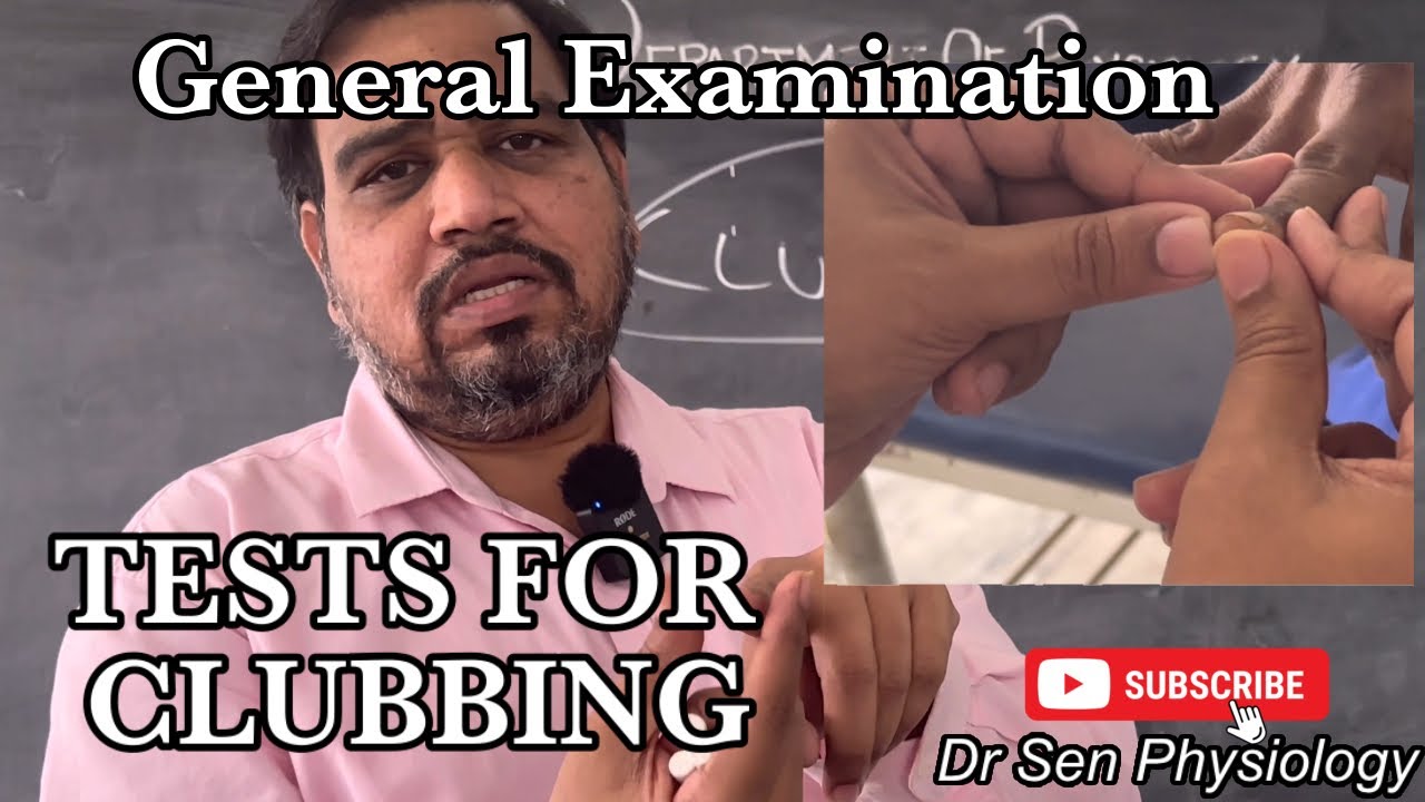 Test for Clubbing .Causes of Clubbing.General Examination - YouTube