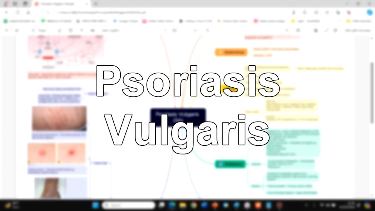 Psoriasis Vulgaris - Definisi, Etiologi, Patofisiologi, Diagnosis ...
