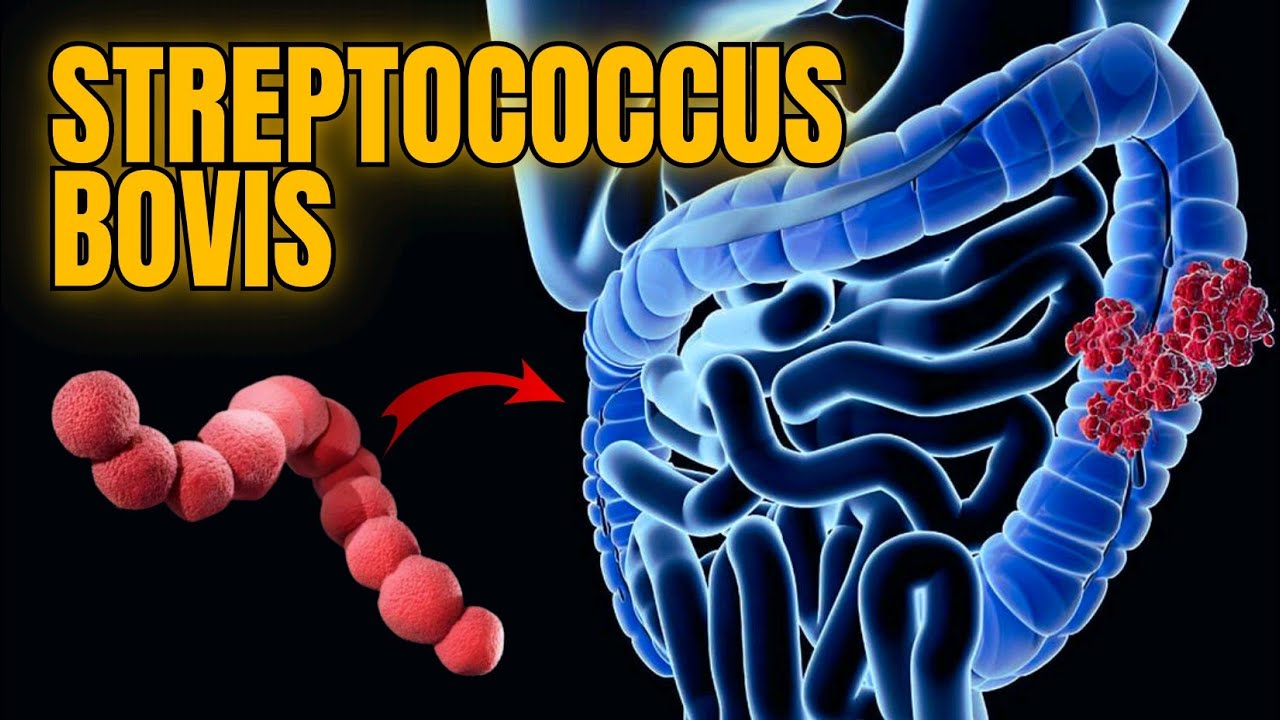 All About Streptococcus bovis: Causes, Pathogenesis, Symptoms ...