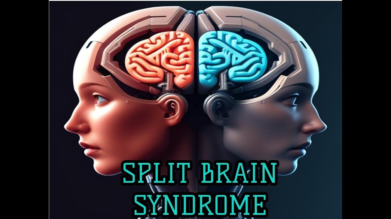 The Mysterious World Of Split Brain Syndrome #brain #medicine - YouTube
