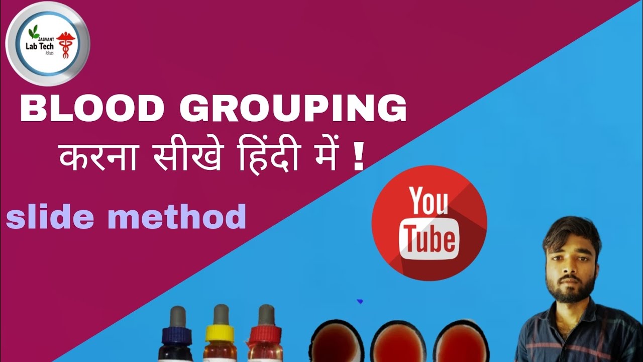 ||ABO Grouping|| Procedure for determination of blood grouping,slide ...