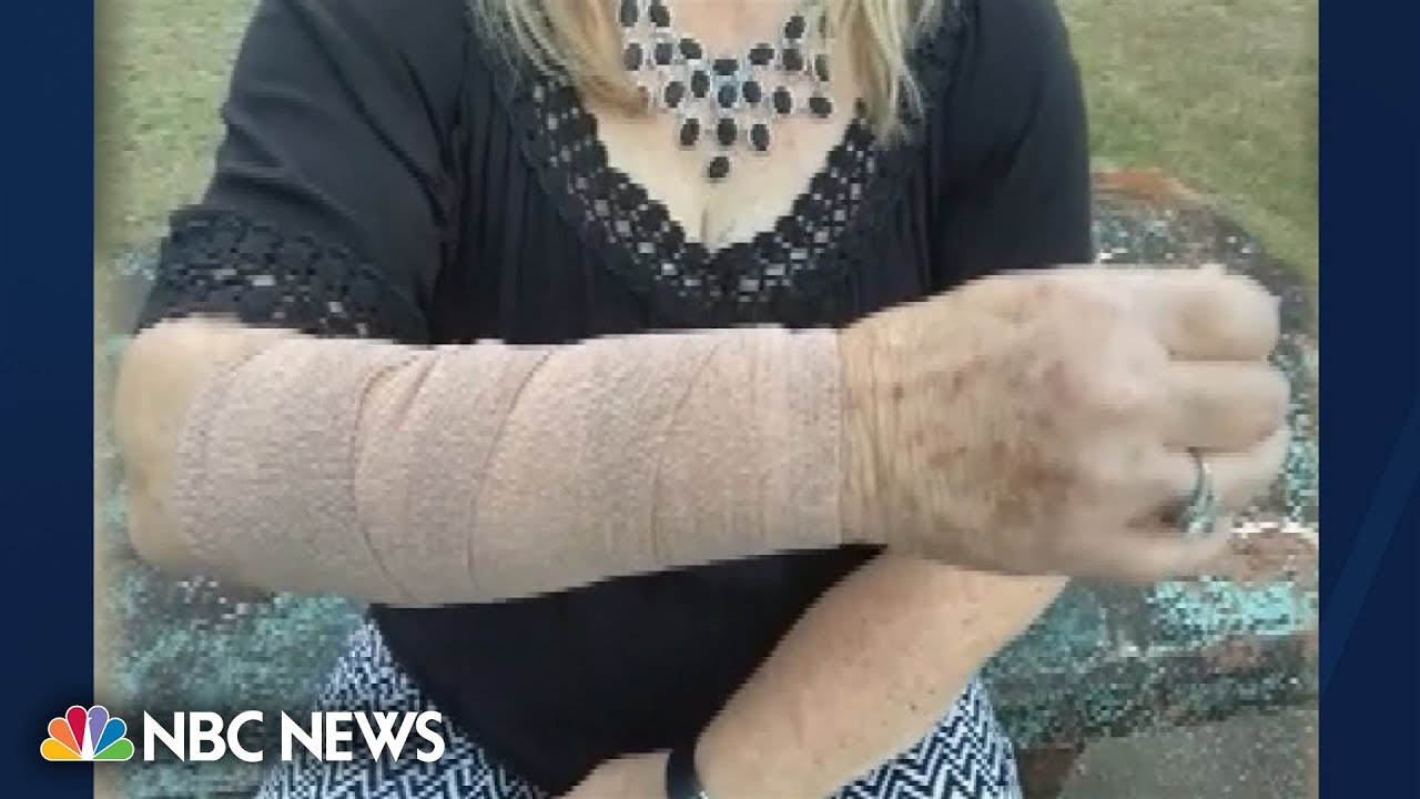 Fangs, feathers and talons: Snake & hawk attack Texas woman - YouTube