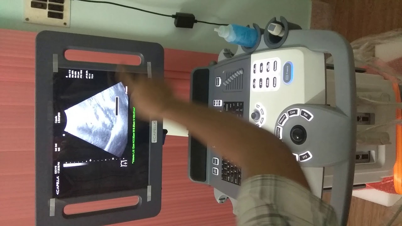 Color Doppler Ultrasound Crystal 40D - YouTube