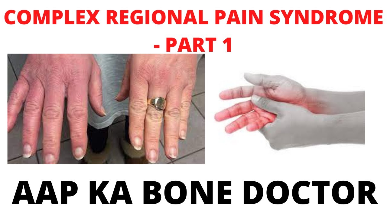 COMPLEX REGIONAL PAIN SYNDROME - PART 1 - EPISODE 46 - YouTube
