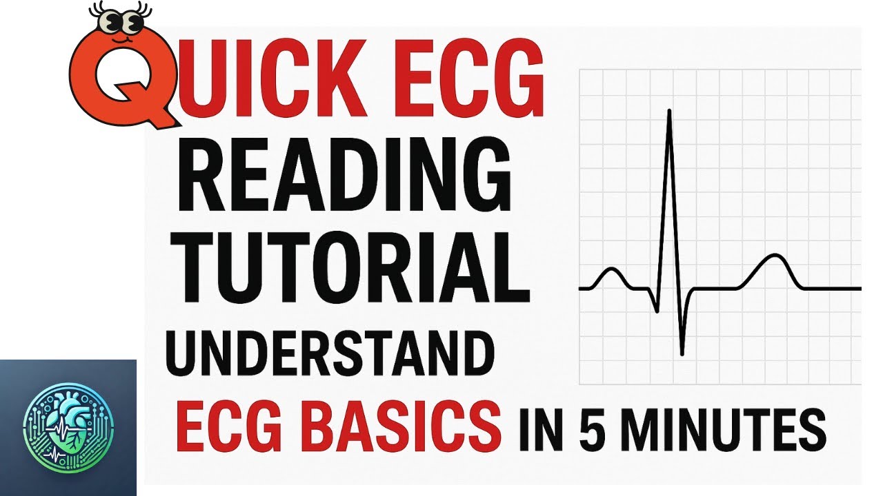 Can You Read an ECG in 5 Minutes: Beginner-Friendly ECG Interpretation ...