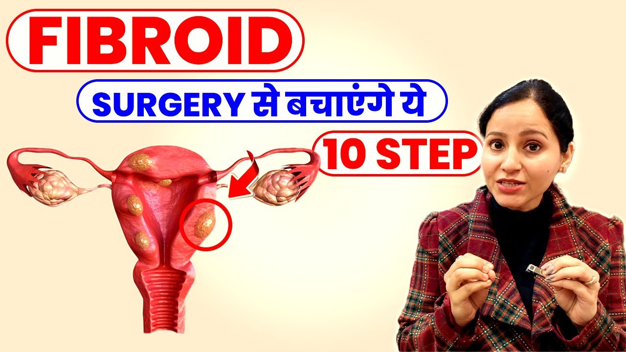 Fibroid Removal Without Surgery | Fibroid Treatment Without Surgery ...