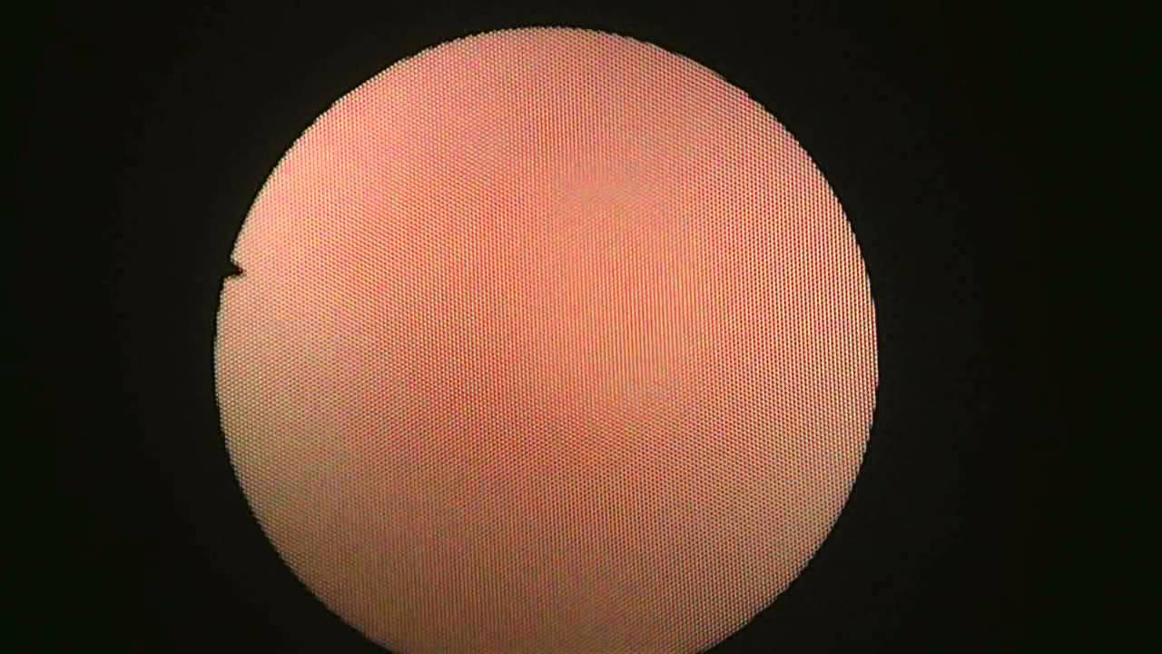 cistoscopia uretra pervia - YouTube