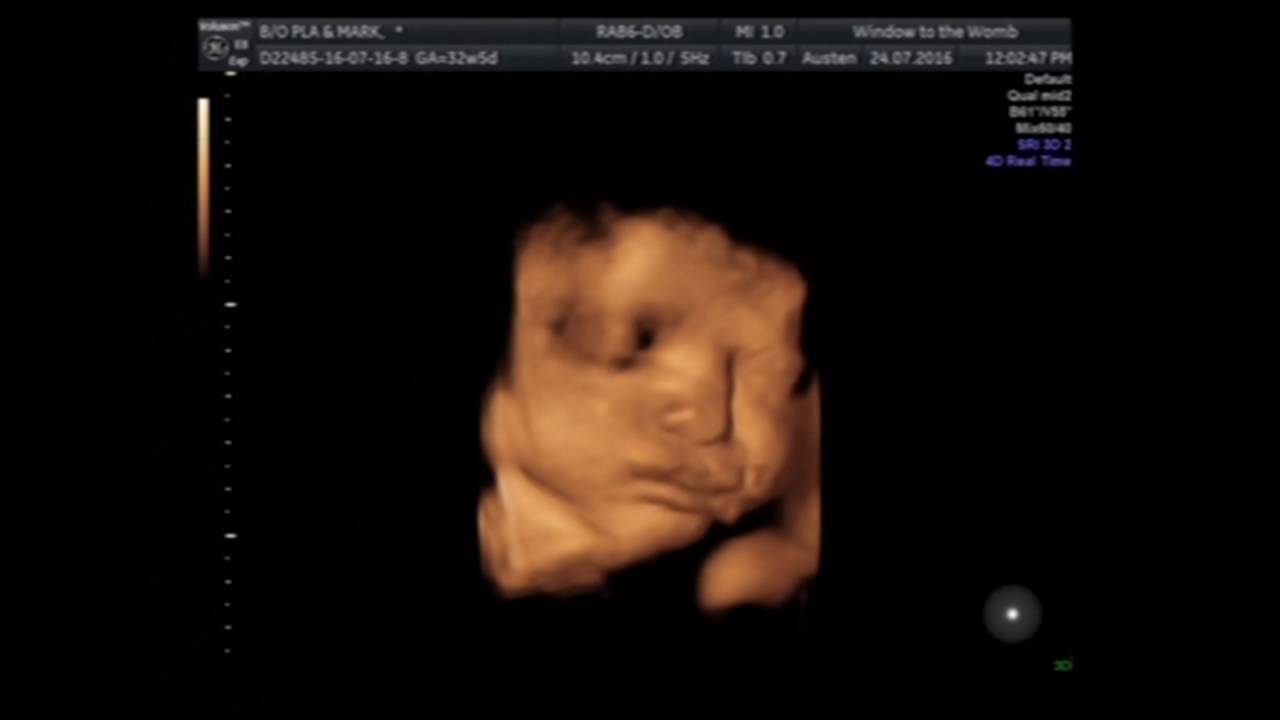 Baby 32 Weeks: 3D/4D HD Ultrasounds - YouTube