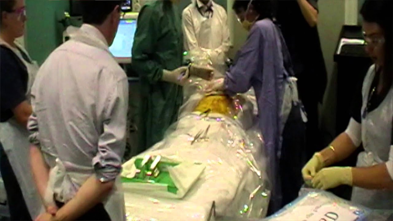 Resternotomy simulation - YouTube