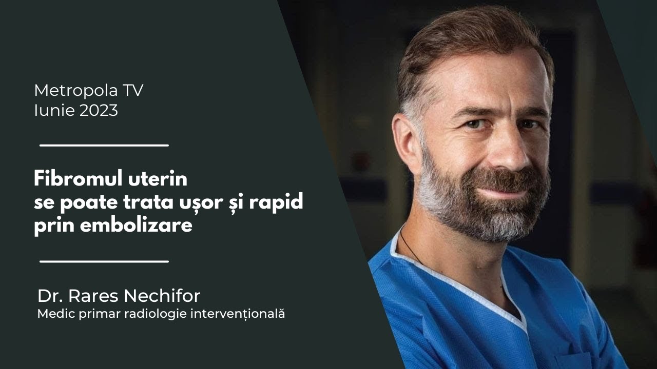 Fibromul uterin se poate trata simplu și rapid prin embolizare I Dr ...