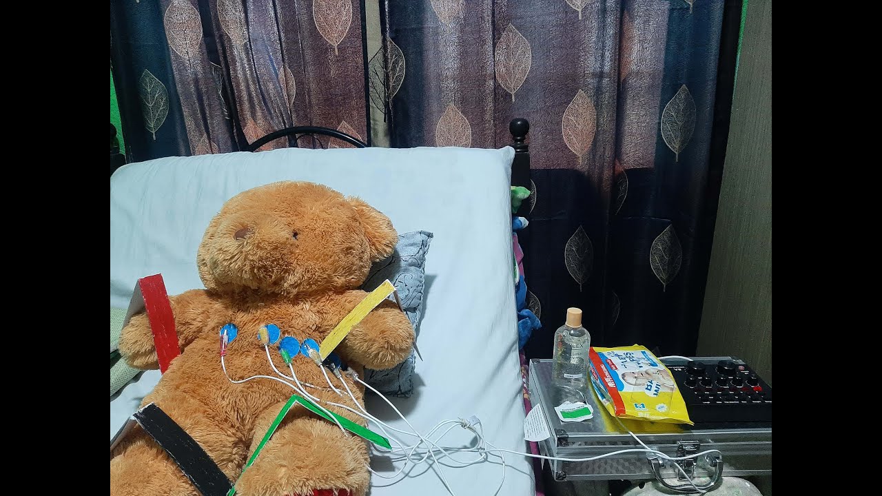 12 Leads ECG Return Demonstration | Christopher Leliza | BSN3 - YouTube