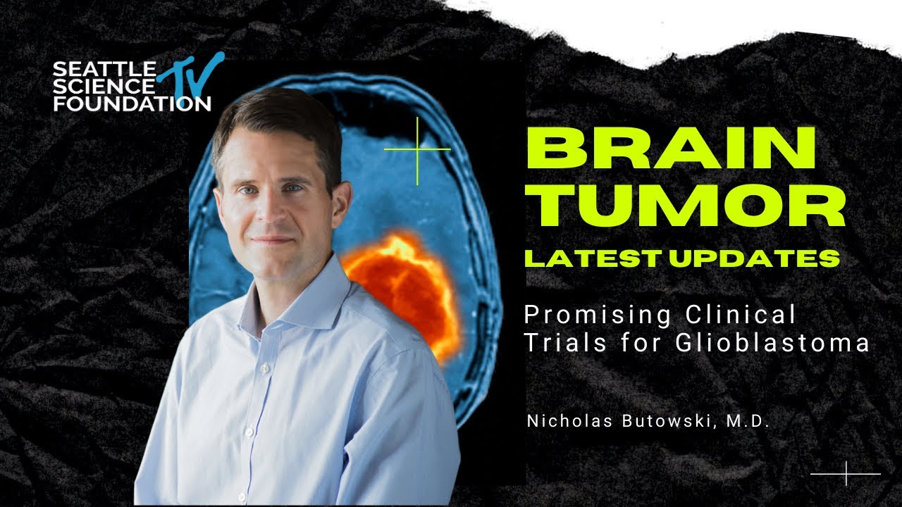 Promising Clinical Trials for Glioblastoma - Nicholas Butowski, M.D ...