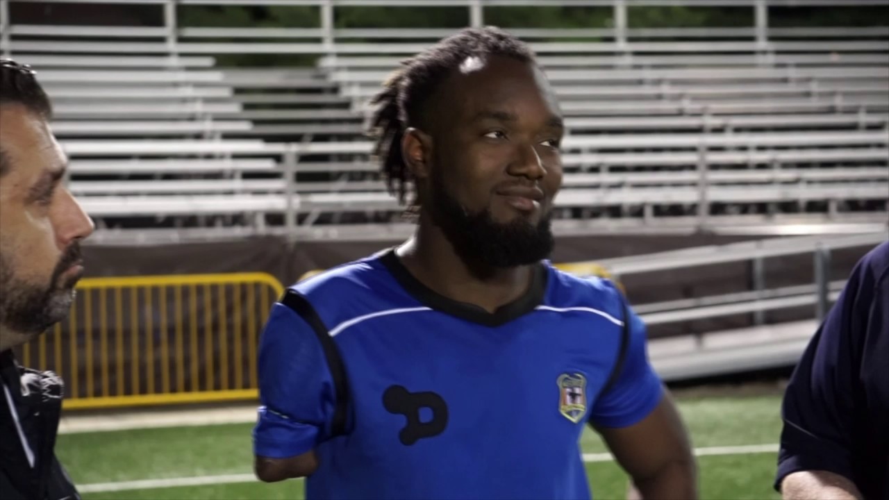 American Amputee League - Words from President Rick Hofmann - YouTube