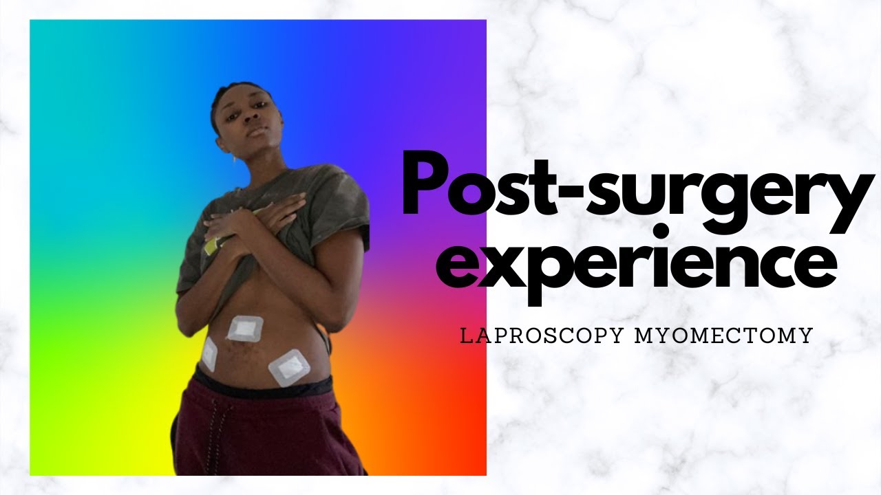 MY SURGERY EXPERIENCE | PART 2 (RECOVERY AND WHAT YOU NEED TO KNOW ...