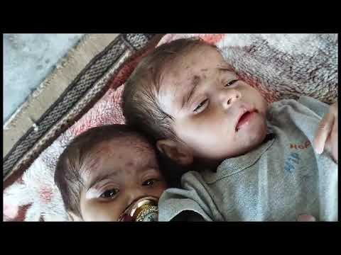 Allah Salami olsun sizlere bu balalarmza komey edey inşallah 4098584494668344