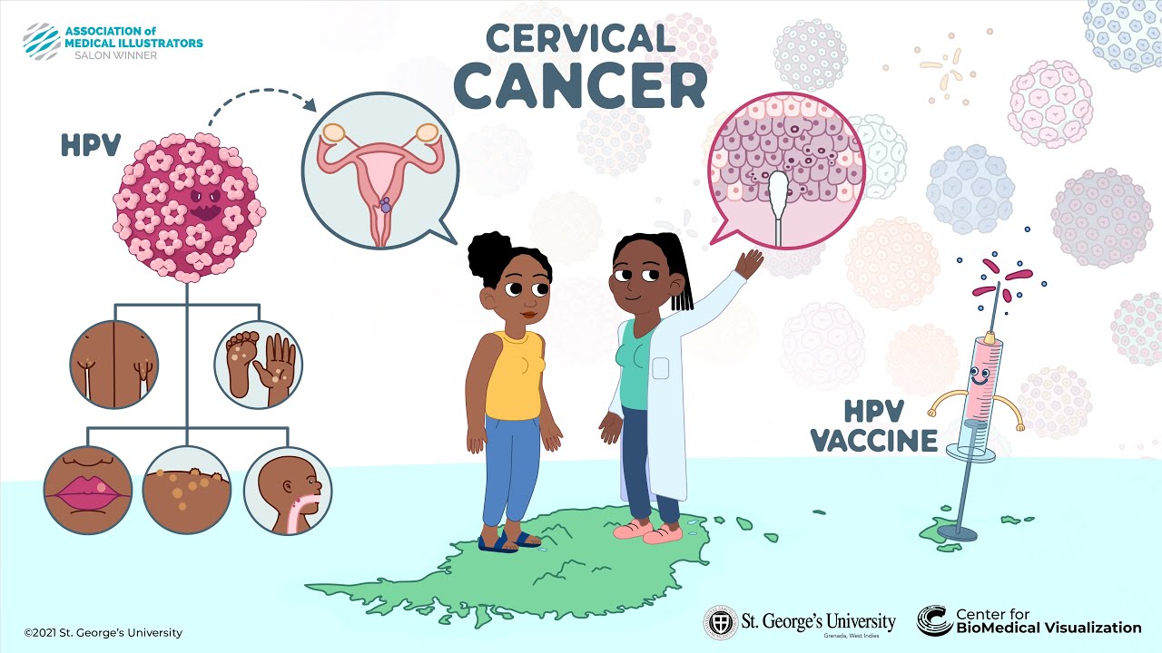 Cervical Cancer - A Public Health Awareness Campaign for the Caribbean ...