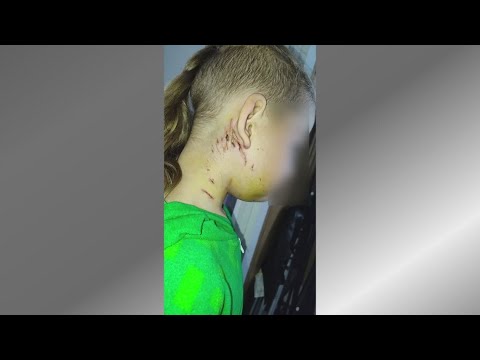 6-year-old Ashland County boy bitten by dog while in handcuffs, 3 adults arrested
