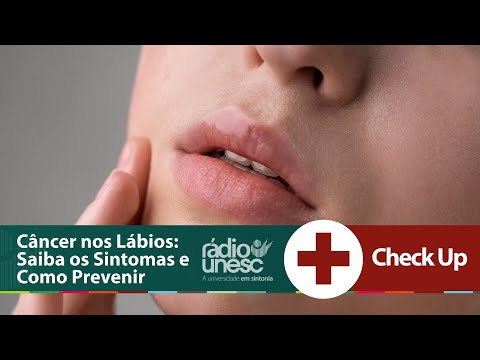 Câncer nos Lábios: Sintomas, Causas e Como se Prevenir | Check Up - YouTube