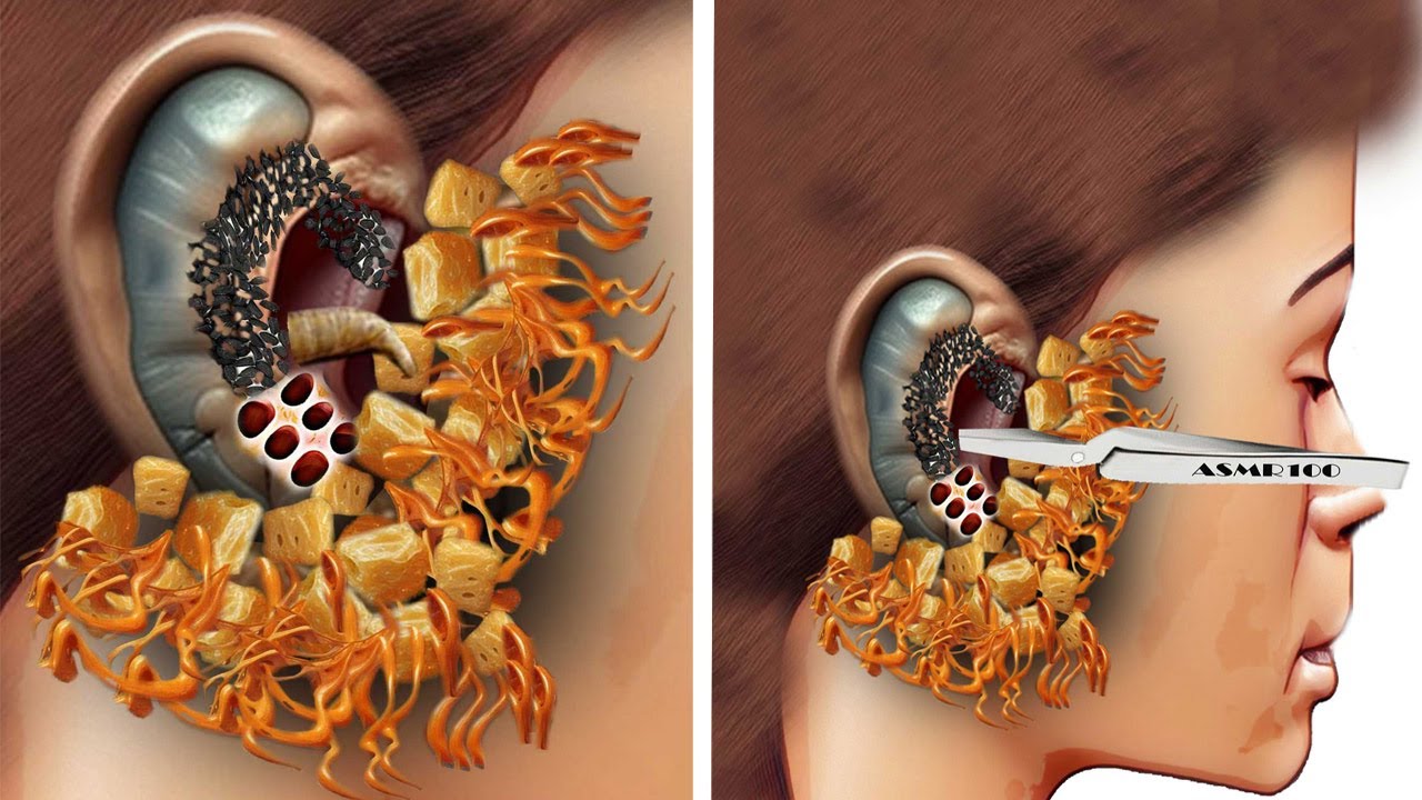 ASMR ANIMATION TREATMENT - YouTube