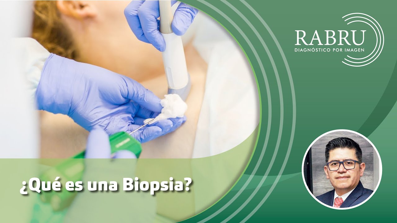 ¿QUÉ ES UNA BIOPSIA? - YouTube