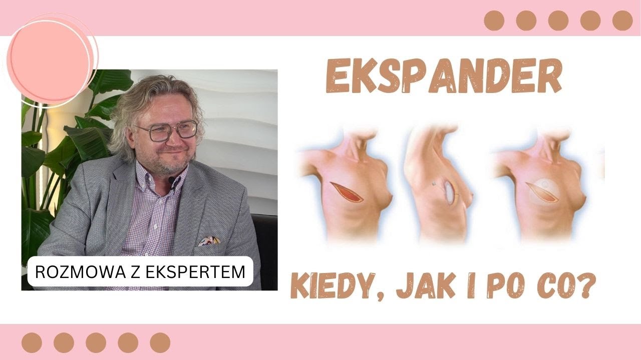 Odcinek 107. Rekonstrukcja piersi z użyciem ekspandera - YouTube