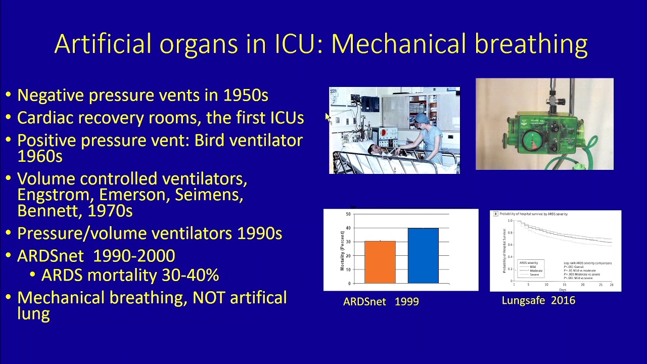 Extracorporeal Life Support in Critical Care - YouTube